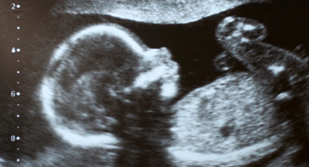 ELECTROENCEPHALOGRAM (EEG) PAEDIATRIC – Total HealthCare Diagnostics